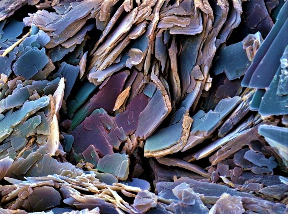 Das Unsichtbare im menschlichen Körper sichtbar machen | Helios ...